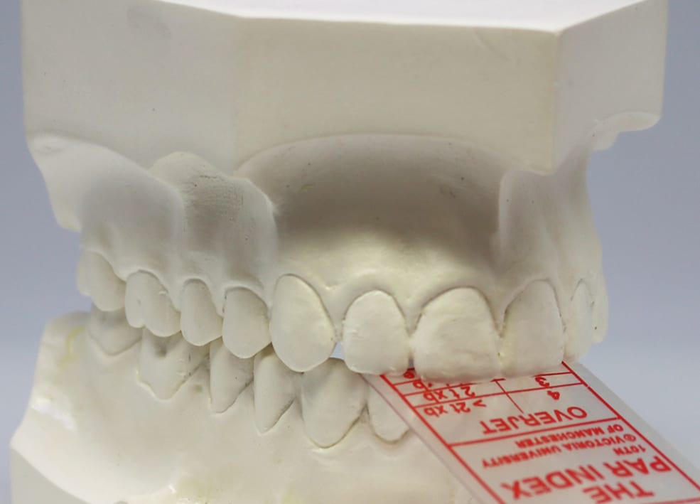 PAR Scoring | Joseph Burke