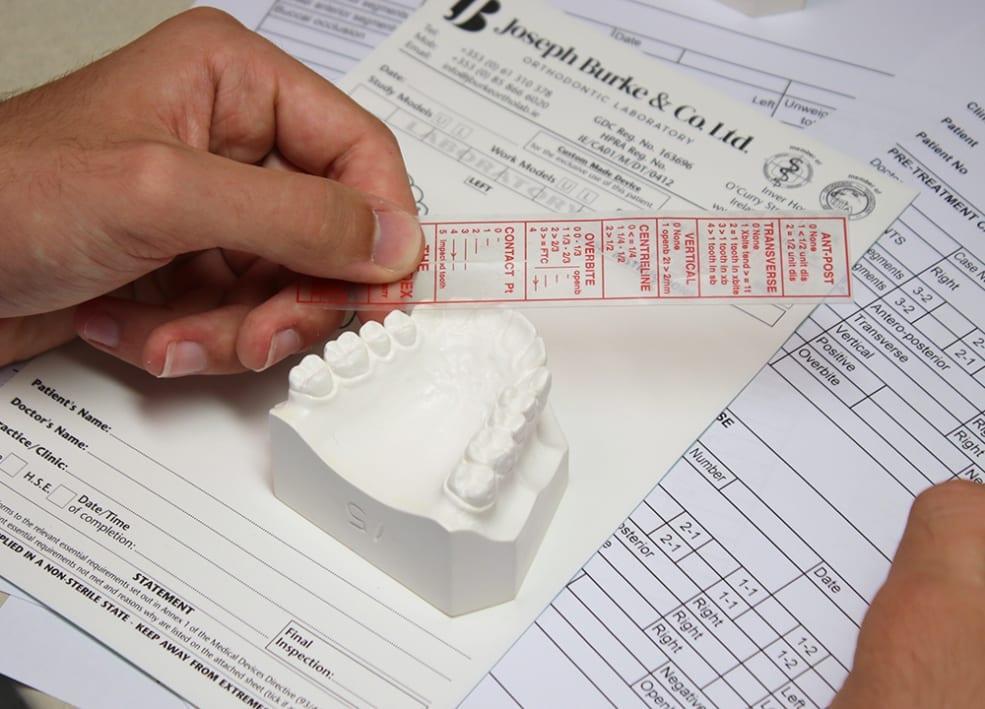 PAR Scoring | Joseph Burke