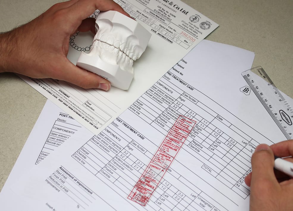 PAR Scoring | Joseph Burke